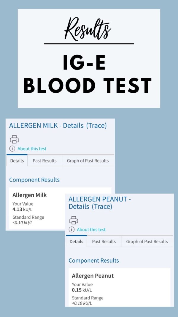 Baby Allergy Testing: What to Expect When You Test For Food Allergies