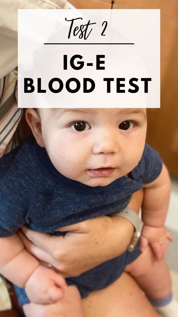 Baby Allergy Testing: What to Expect When You Test For Food Allergies