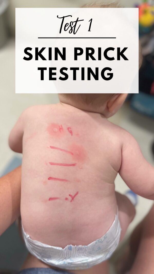 Baby Allergy Testing: What to Expect When You Test For Food Allergies